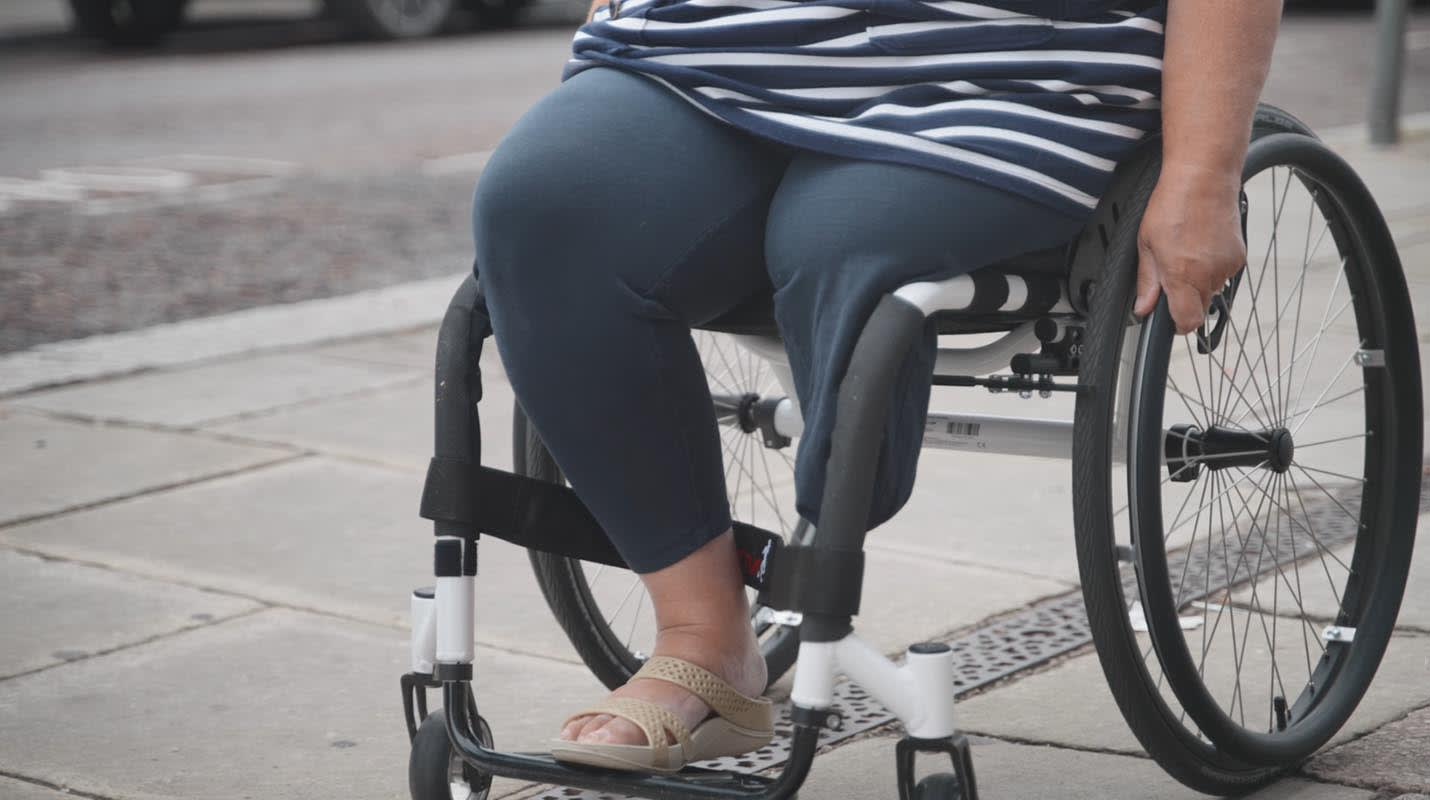 Tracey's Story: Life following an amputation claim