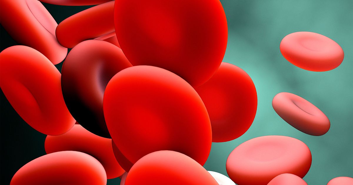 Types of porphyria: acute, cutaneous and more - Sharecare