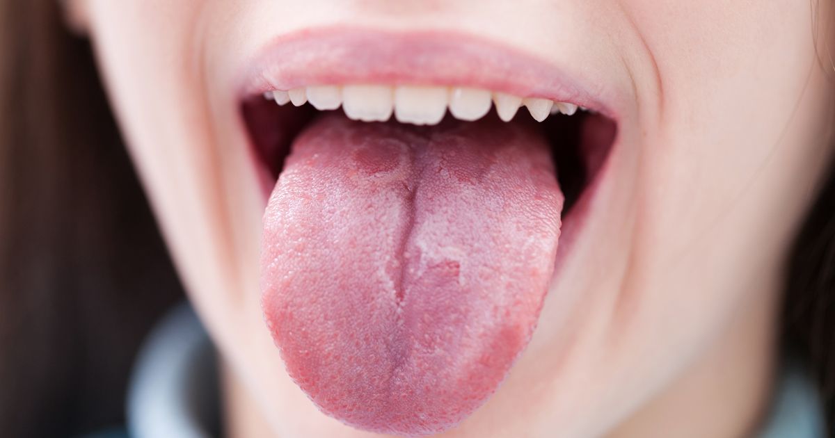What Your Tongue Reveals About Your Health | oral-health - Sharecare What Your Tongue Reveals About Your Health | oral-health - Sharecare